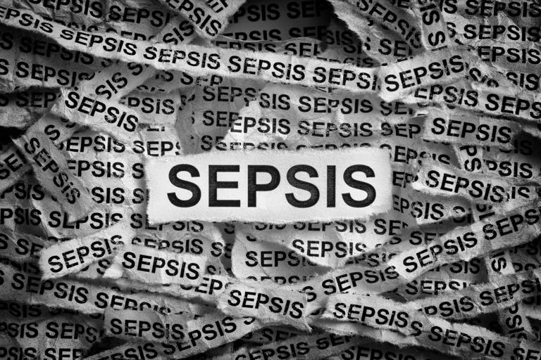 Five signs of sepsis you need to know and act on immediately ...